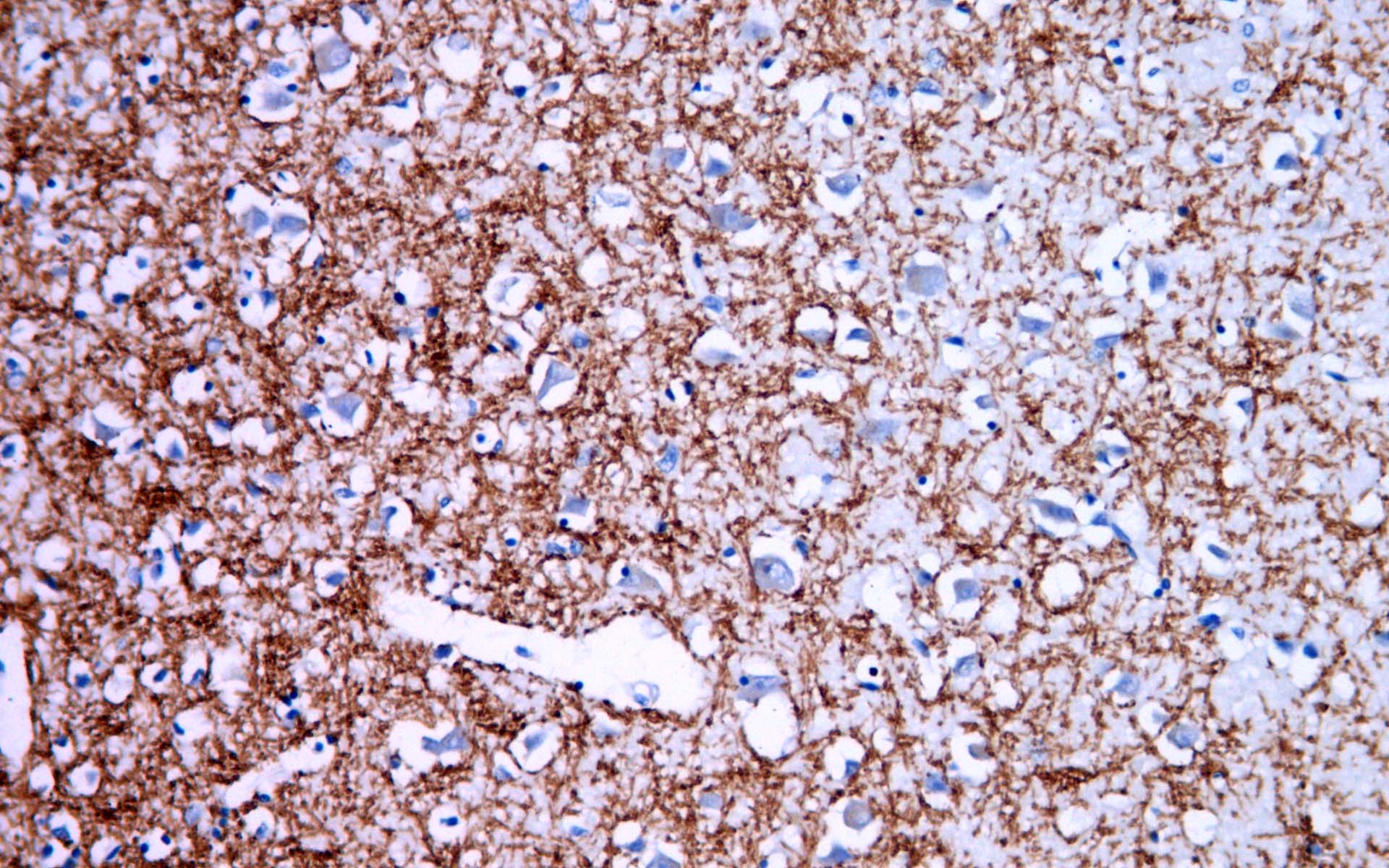 MBP - Rabbit Monoclonal antibody(Mab) IHC-P - Buy Now! |Abcepta