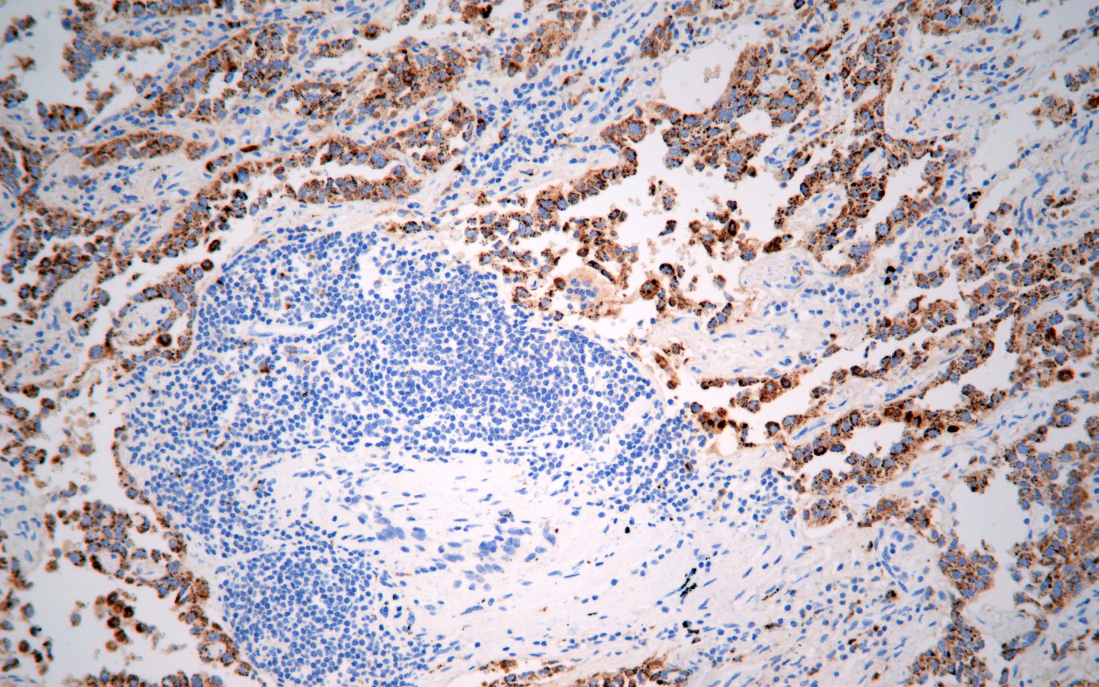 Napsin A - Rabbit Monoclonal antibody(Mab) IHC-P - Buy Now! |Abcepta