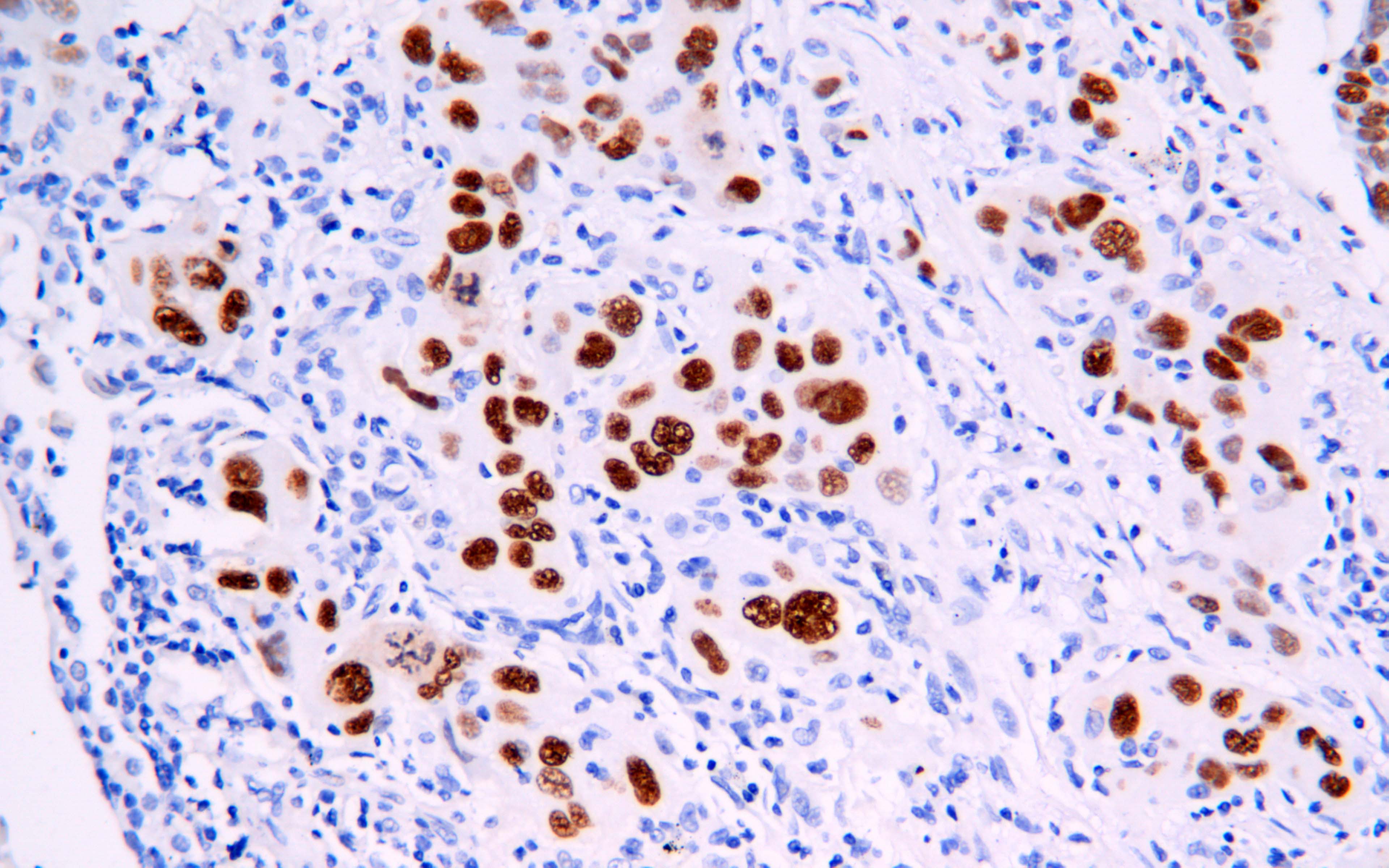 TTF-1 - Rabbit Monoclonal antibody(Mab) IHC-P - Buy Now! |Abcepta