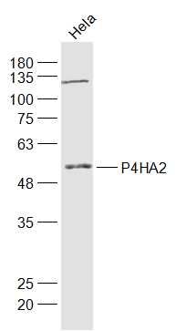 P4HA2 Polyclonal Antibody - Purified Rabbit Polyclonal Antibody (Pab ...