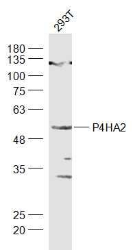 P4HA2 Polyclonal Antibody - Purified Rabbit Polyclonal Antibody (Pab ...