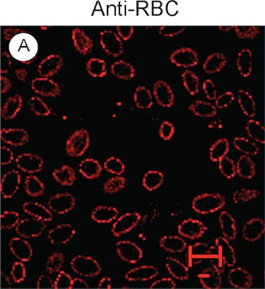 Anti-CHICKEN Red Blood Cell (RBC) (RABBIT) Antibody - Chicken Red Blood ...